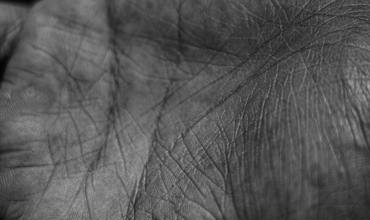 Body | ShunKeto