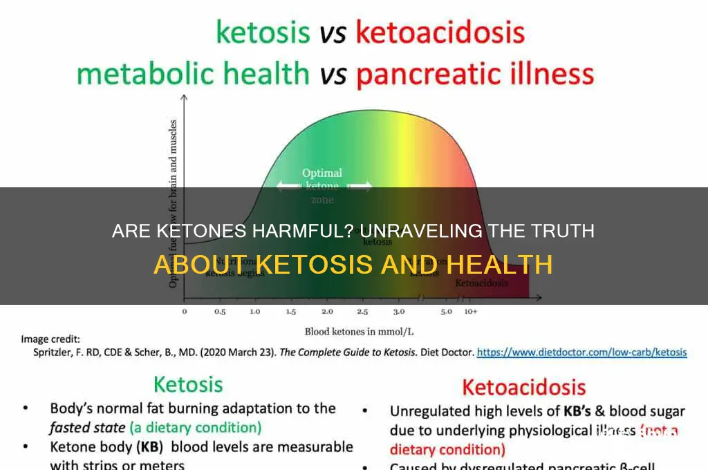 Are Ketones Harmful? Unraveling The Truth About Ketosis And Health ...