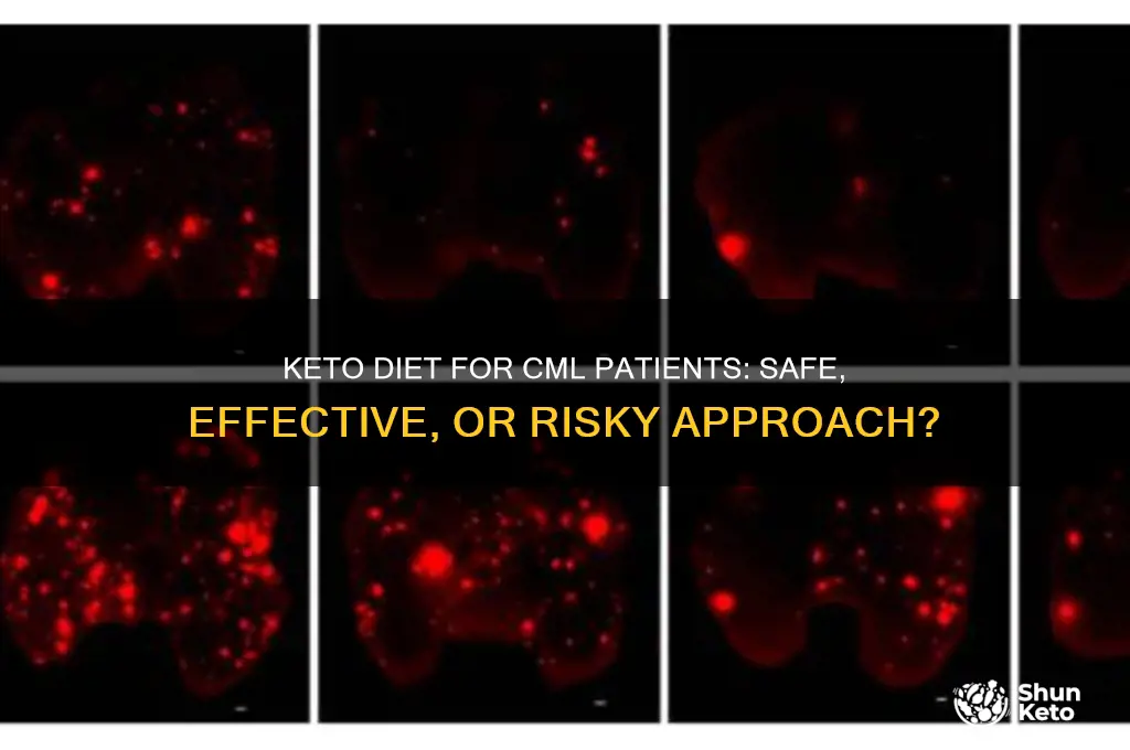 Keto Diet For Cml Patients: Safe, Effective, Or Risky Approach? | ShunKeto
