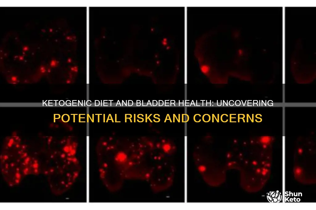 Ketogenic Diet And Bladder Health: Uncovering Potential Risks And ...