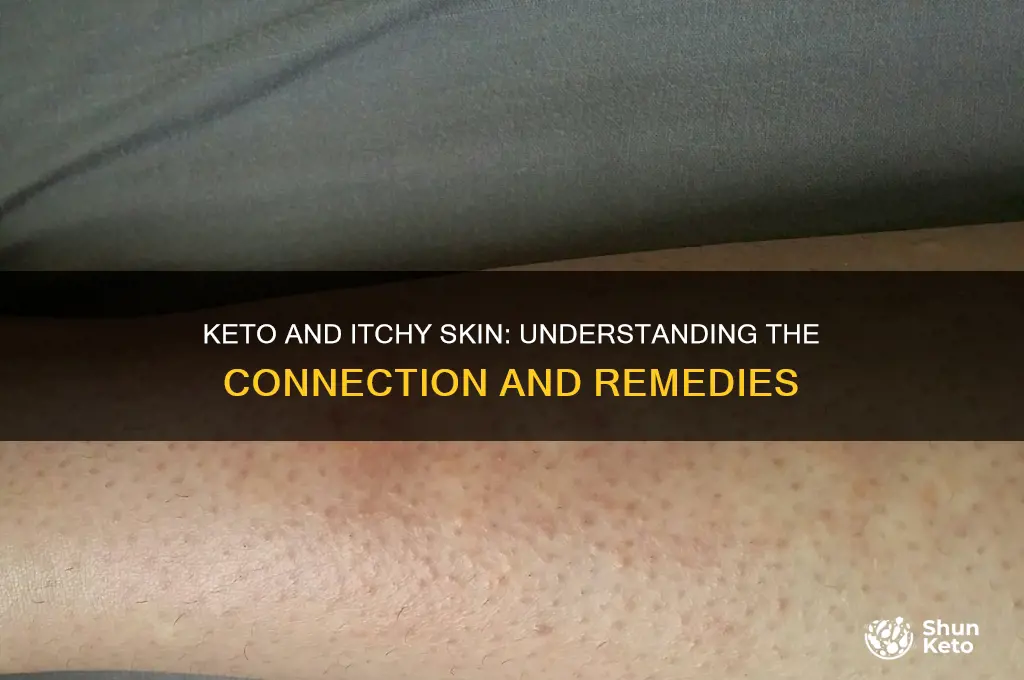 Keto And Itchy Skin: Understanding The Connection And Remedies | ShunKeto