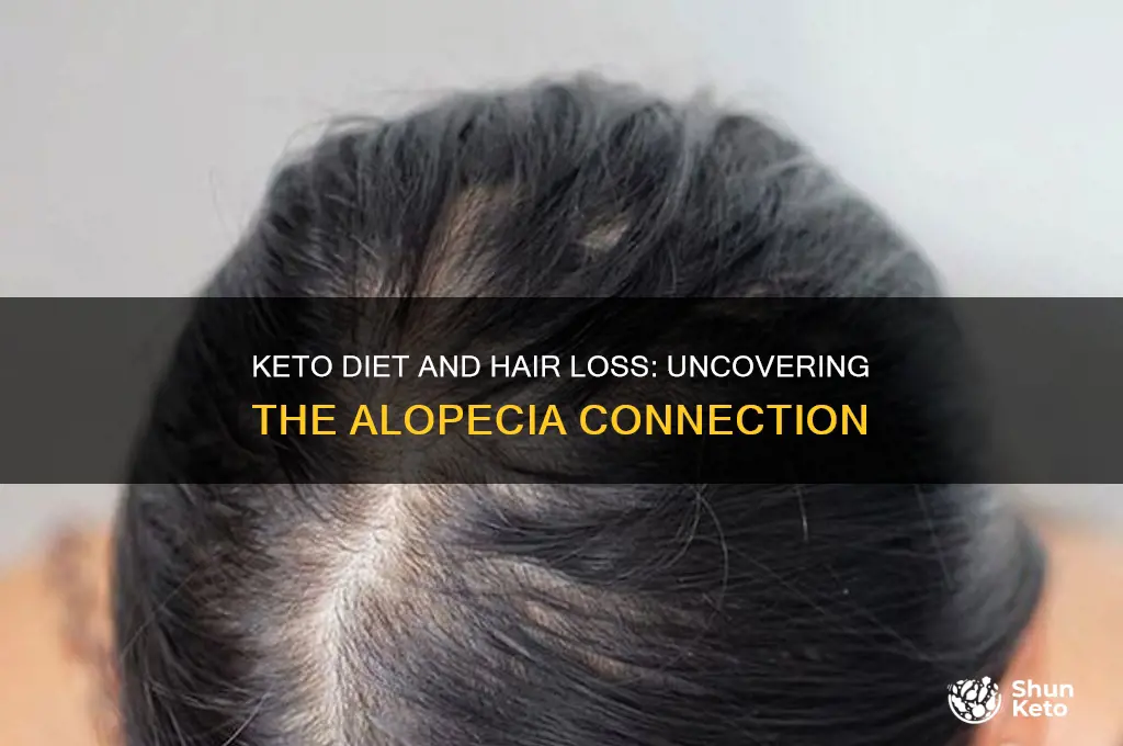 Keto Diet And Hair Loss: Uncovering The Alopecia Connection | ShunKeto