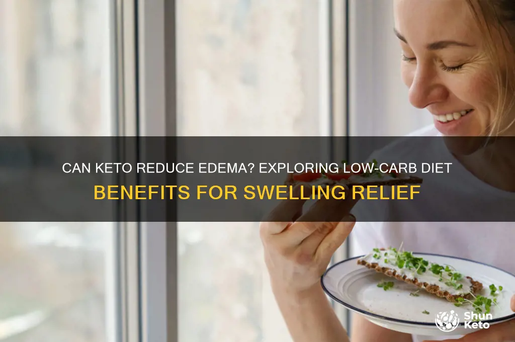 Can Keto Reduce Edema? Exploring Low-Carb Diet Benefits For Swelling ...