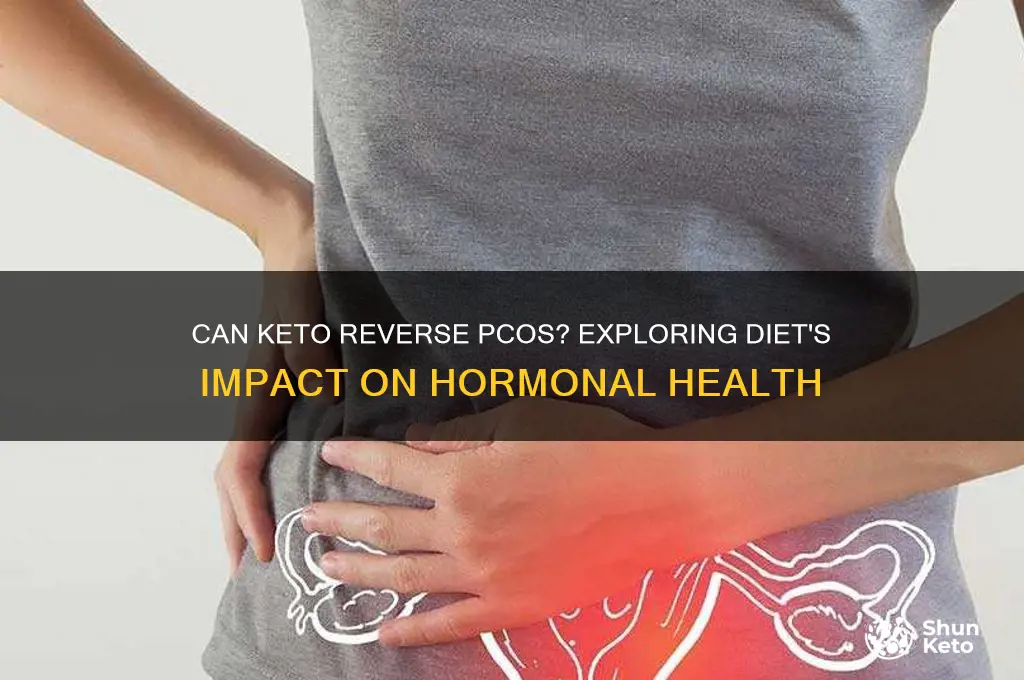 Can Keto Reverse Pcos? Exploring Diet's Impact On Hormonal Health ...