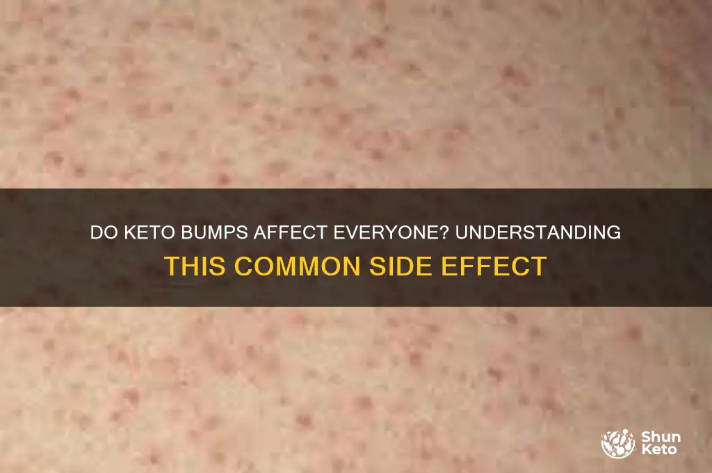 Do Keto Bumps Affect Everyone? Understanding This Common Side Effect ...
