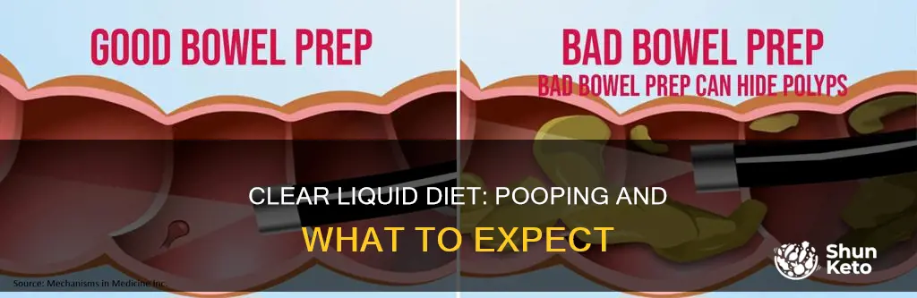 Clear Liquid Diet: Pooping And What To Expect | ShunKeto
