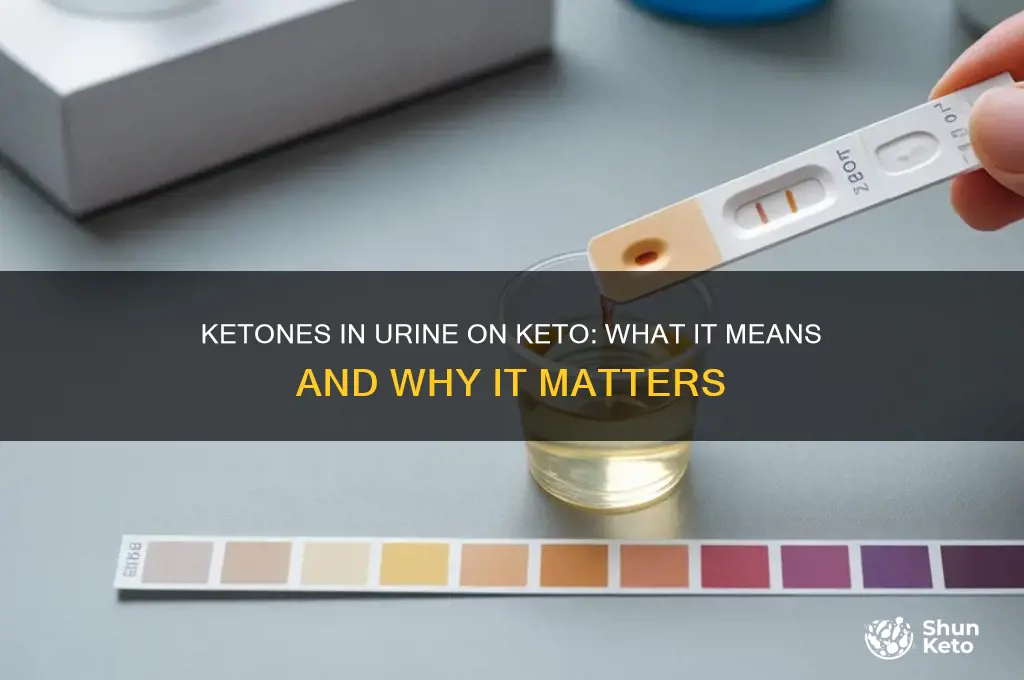 Ketones In Urine On Keto: What It Means And Why It Matters | ShunKeto
