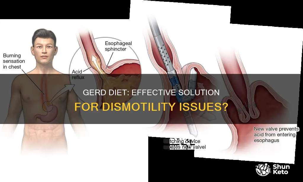 Gerd Diet: Effective Solution For Dismotility Issues? | ShunKeto