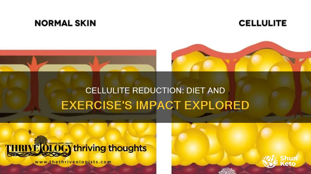 Cellulite Reduction: Diet And Exercise's Impact Explored | ShunKeto