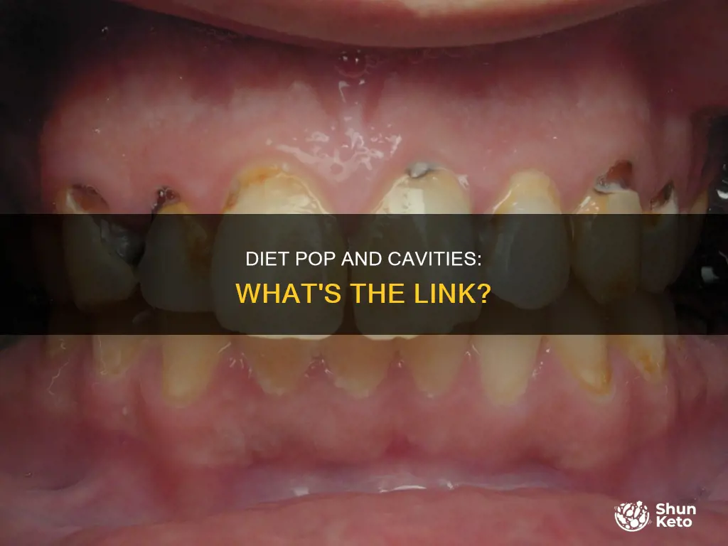 Diet Pop And Cavities: What's The Link? | ShunKeto