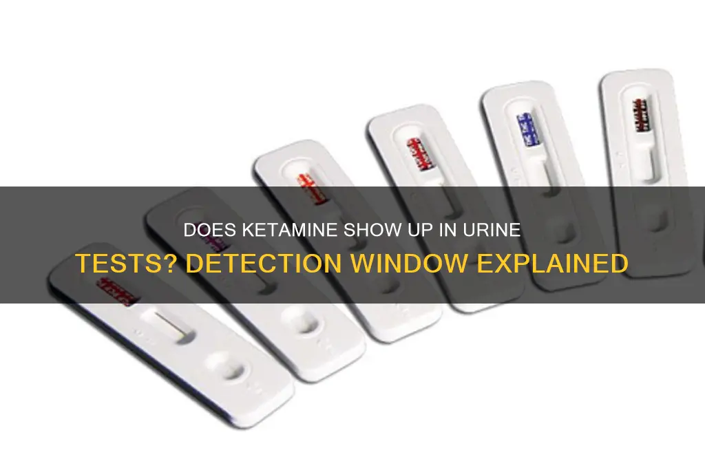 Does Ketamine Show Up In Urine Tests? Detection Window Explained | ShunKeto