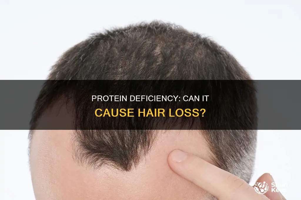 Protein Deficiency: Can It Cause Hair Loss? | ShunKeto