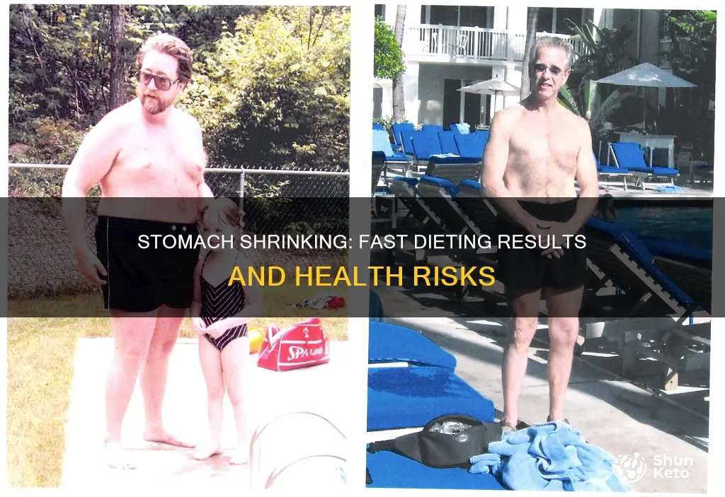 Stomach Shrinking: Fast Dieting Results And Health Risks | ShunKeto