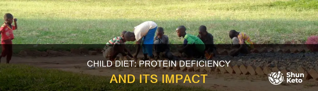 Child Diet: Protein Deficiency And Its Impact | ShunKeto