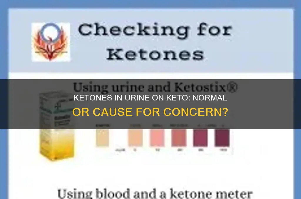 Ketones In Urine On Keto: Normal Or Cause For Concern? | ShunKeto
