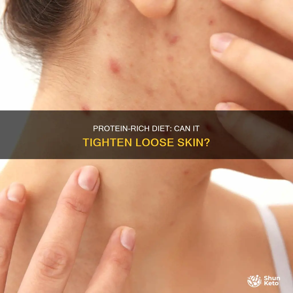 Protein-Rich Diet: Can It Tighten Loose Skin? | ShunKeto